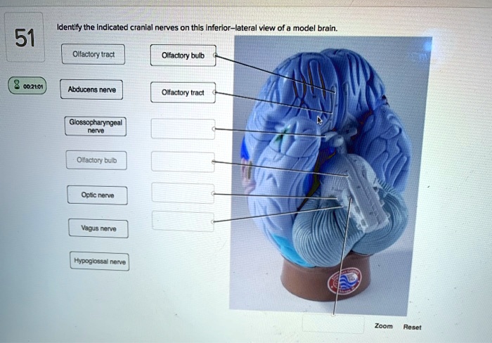 51 Identify the indicated cranial nerves on this inferior-lateral view ...