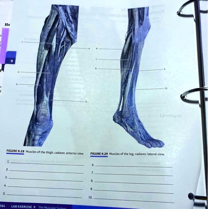 texts he complete figure 928 muscles of the thigh cadaver anterior view ...