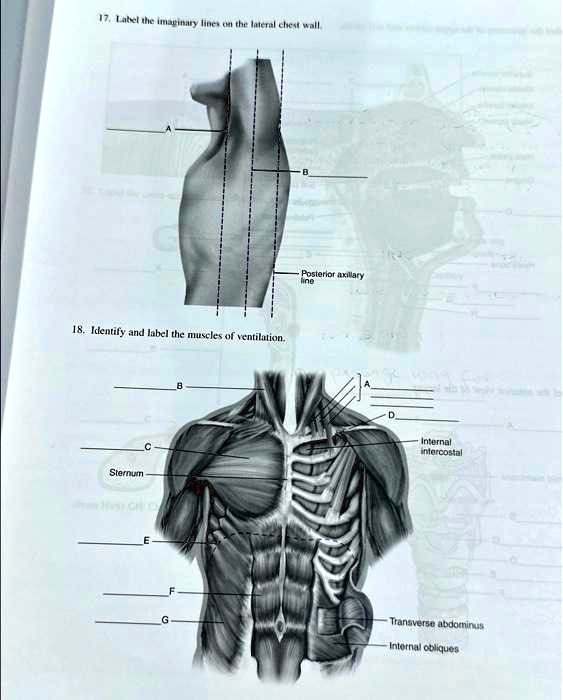 SOLVED: 7.Label the imaginary tin on the lateral chet wall Posterior ...