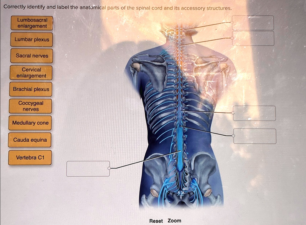 Correctly identify and label the anatomical parts of the spinal cord and its accessory ...