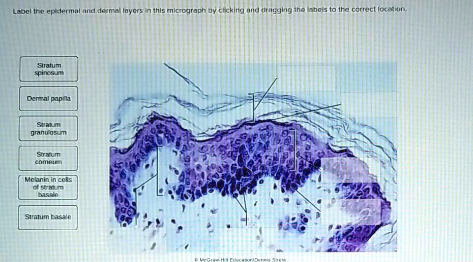 Label the epidermal and dermal layers in this micrograph by clicking ...