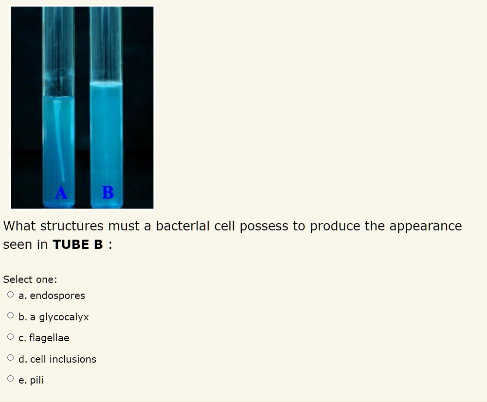 SOLVED B What Structures Must A Bacterial Cell Possess To Produce The solved-b-what-structures-must-a-bacterial-cell-possess-to-produce-the