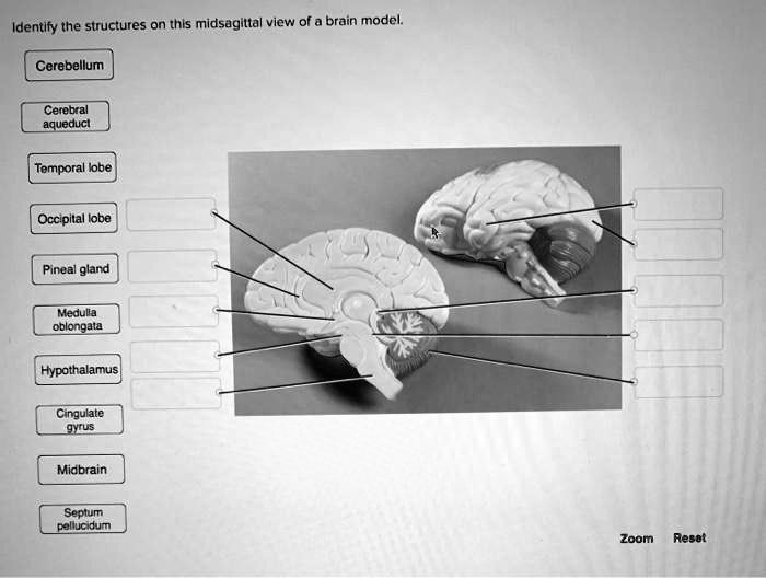 Identify the structures on this midsagittal view of a brain model ...