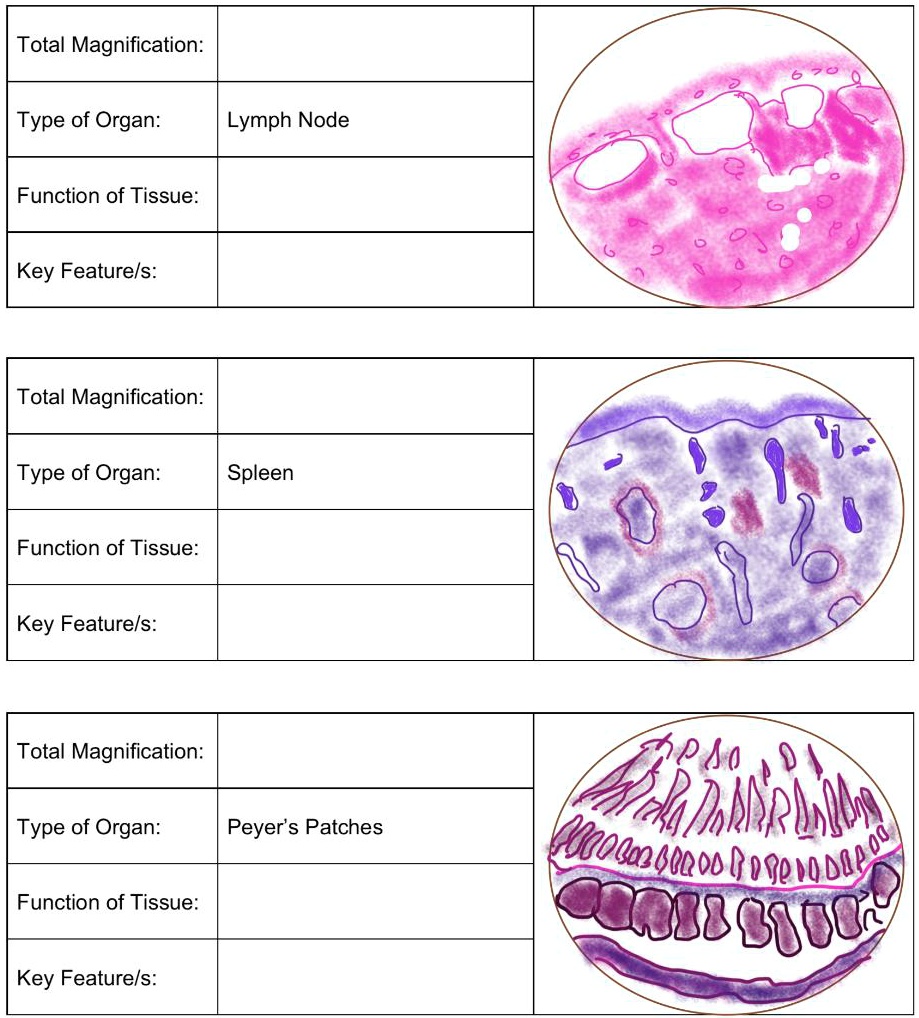 Total Magnification: Type of Organ: Lymph Node Function of Tissue: Key ...