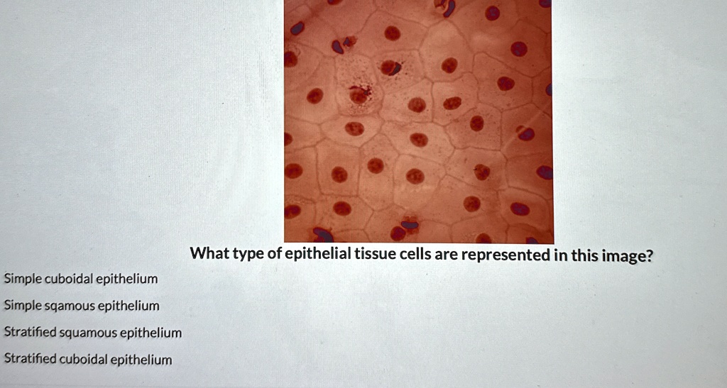 simple cuboidal epithelium simple sqamous epithelium stratified ...