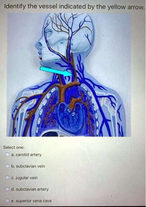 Identify the vessel indicated by the yellow arrow. Select one: a. carotid artery b. subclavian ...