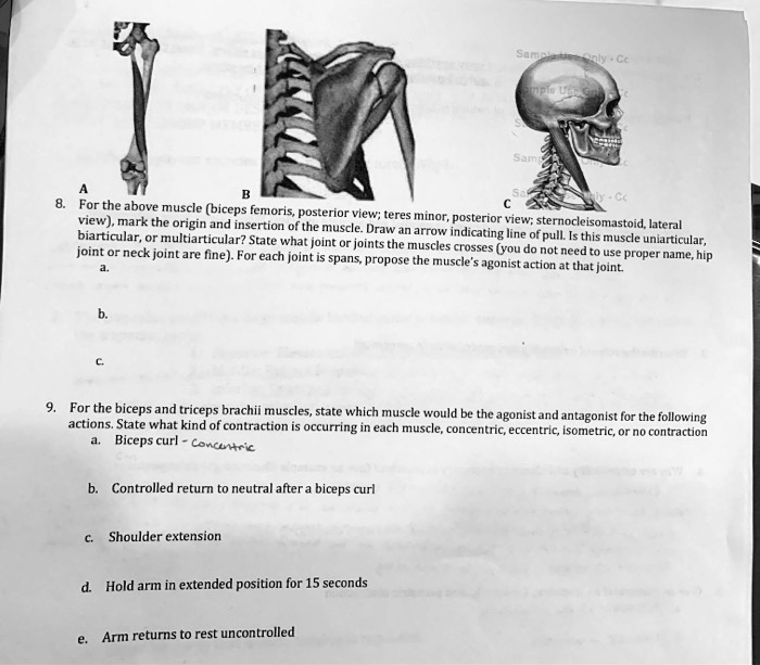 SOLVED: 8. For the above muscles (biceps femoris, posterior view; teres ...