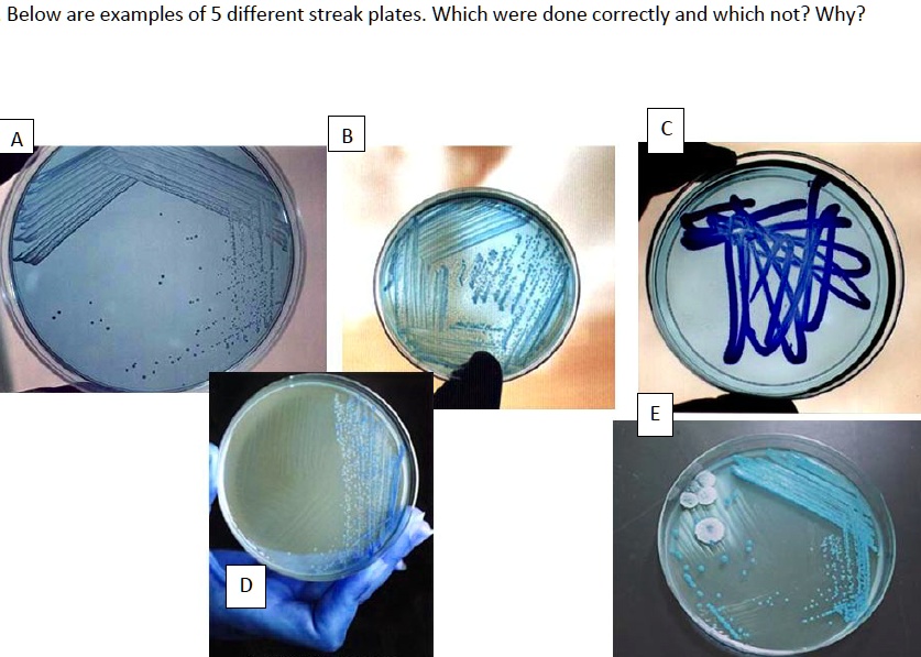 below are examples of 5 different streak plates which were done ...