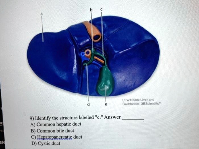 [GET ANSWER] 9) Identify the structure labeled "c." Answer A) Common ...