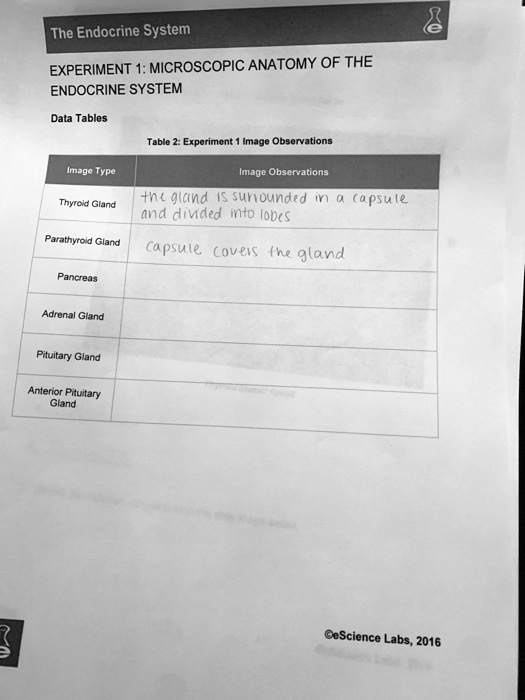 SOLVED: The Endocrine System EXPERIMENT 1: MICROSCOPIC ANATOMY OF THE ...