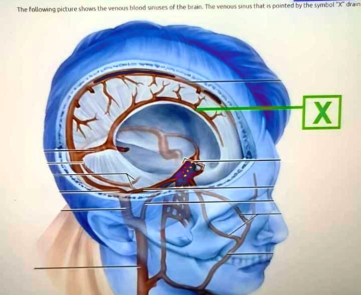 The following picture shows the venous blood sinuses of the brain. The ...