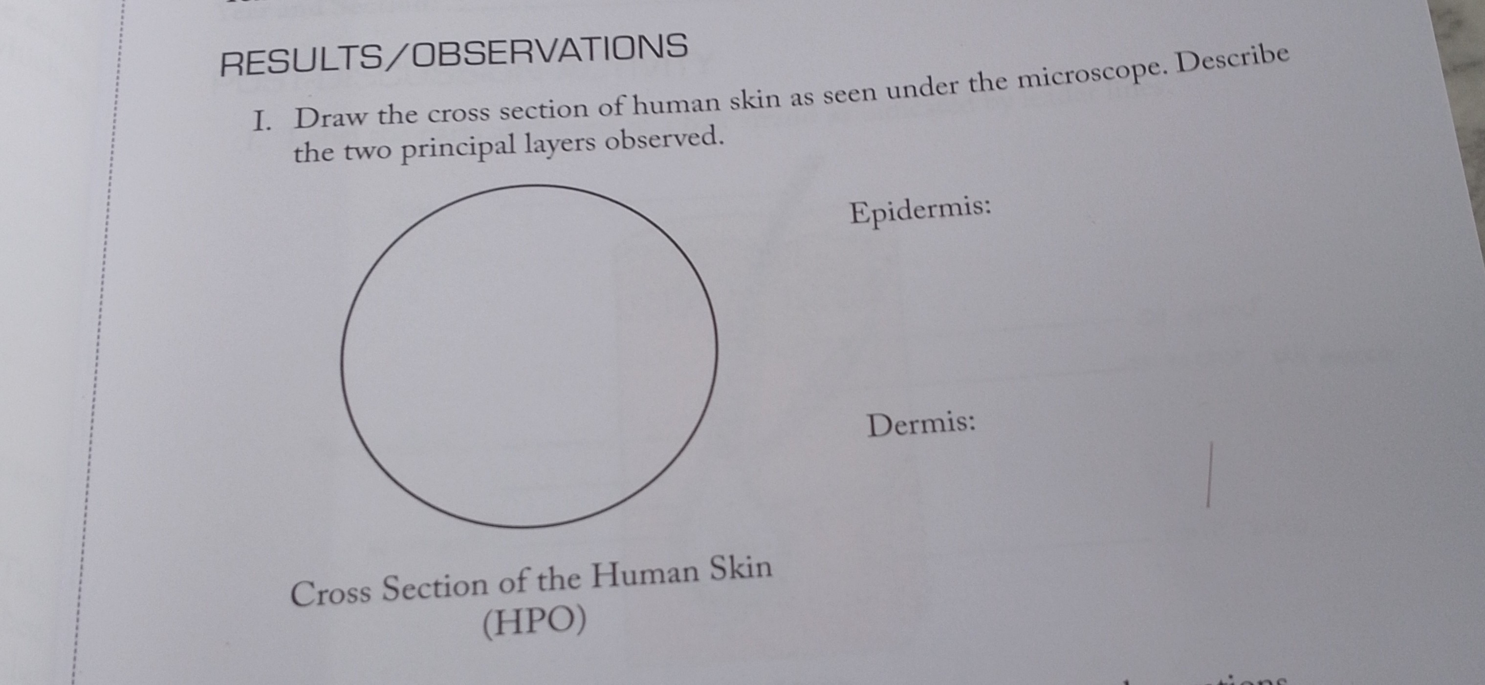 RESULTS/OBSERVATIONS I. Draw the cross section of human skin as seen ...