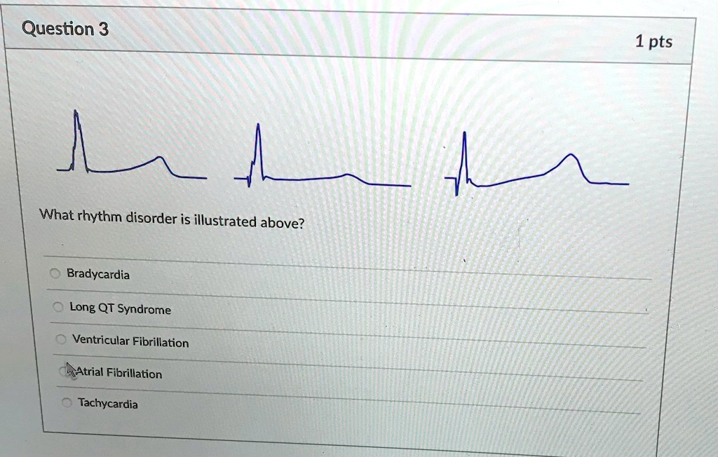 question 3 what rhythm disorder is illustrated above bradycardia long ...