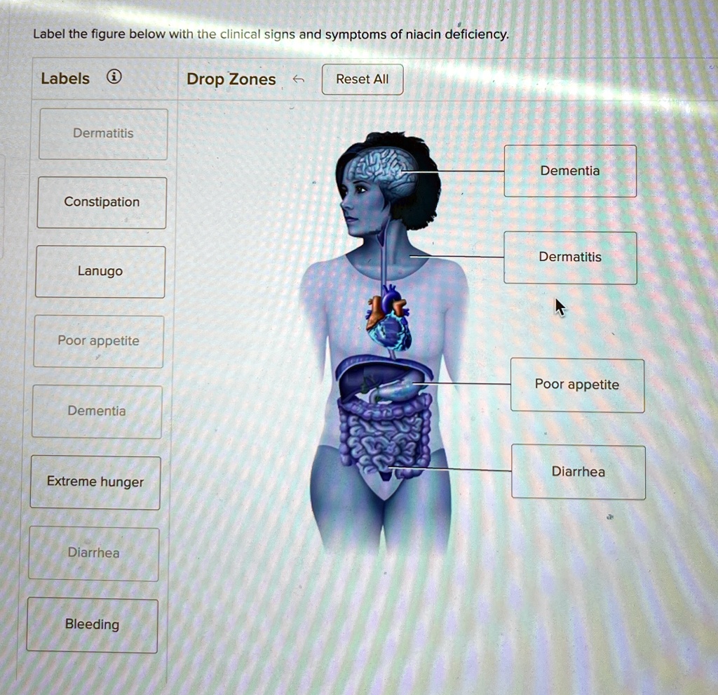 label the figure below with the clinical signs and symptoms of niacin deficiency labels ...