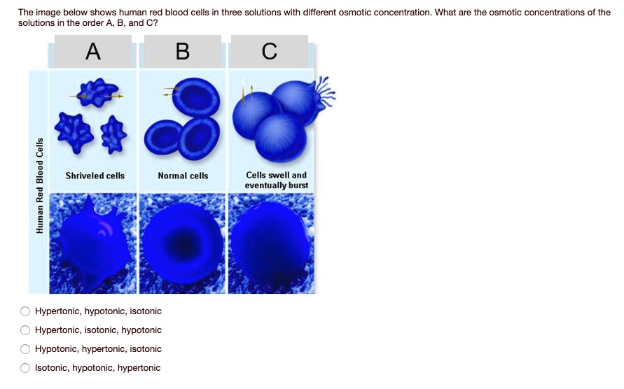 SOLVED: The image below shows human red blood cells in three solutions ...