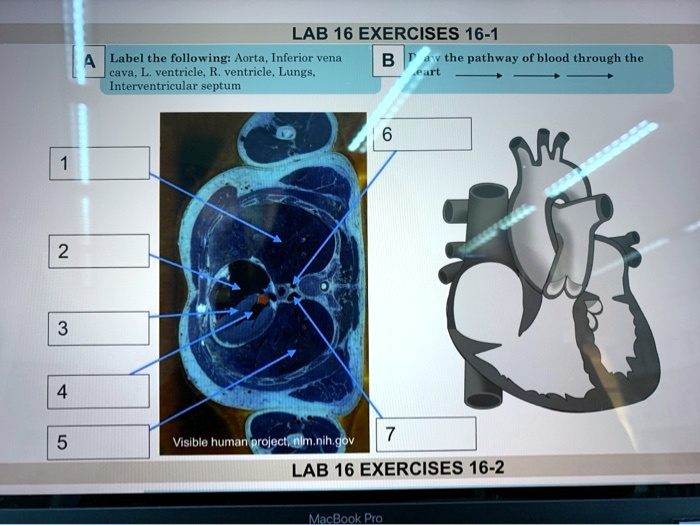LAB 16 EXERCISES 16-1 A Label the following: Aorta, Inferior vena cava ...