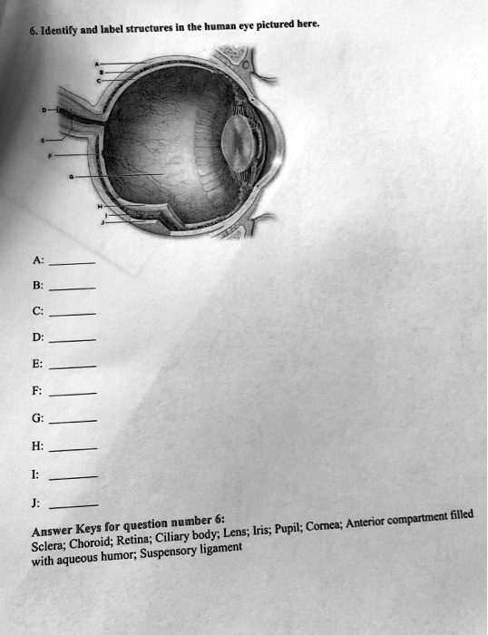 SOLVED:Identify and label structures In the human eye pictured here ...