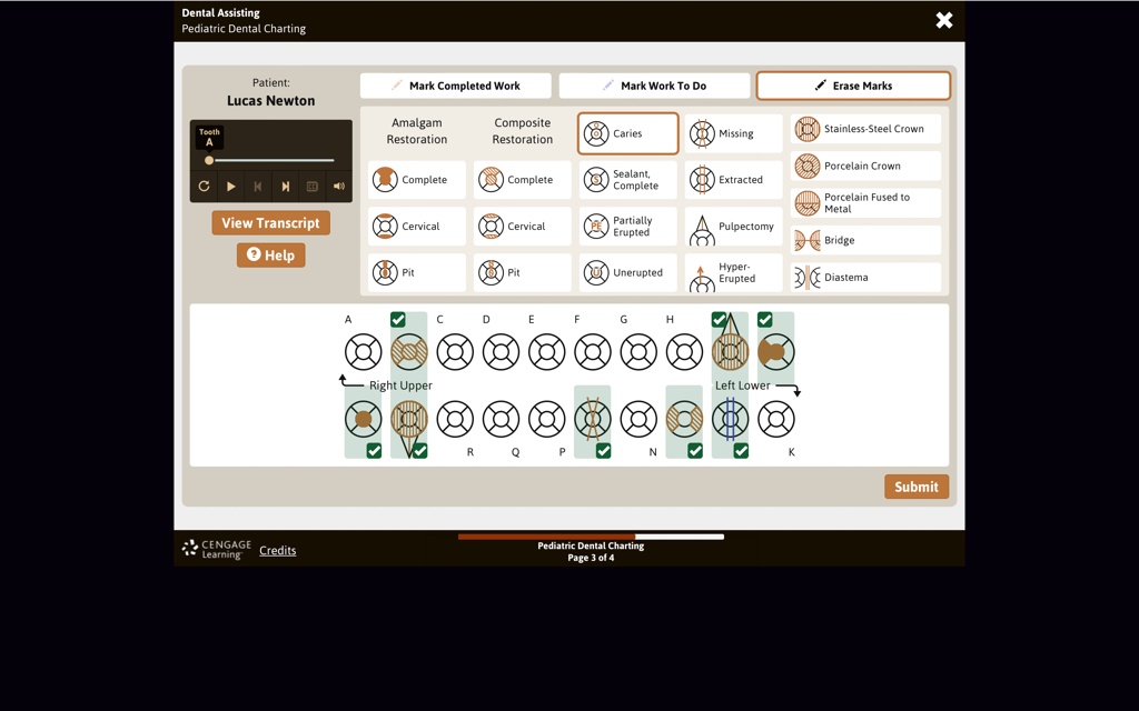 SOLVED: How do I chart the following? Tooth A has Mesial Occlusal ...