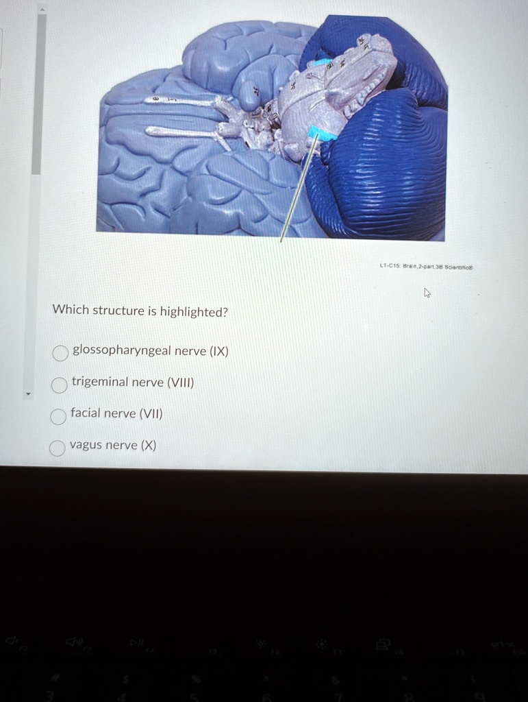 which structure is highlighted glossopharyngeal nerve ix trigeminal nerve viii facial nerve vii ...