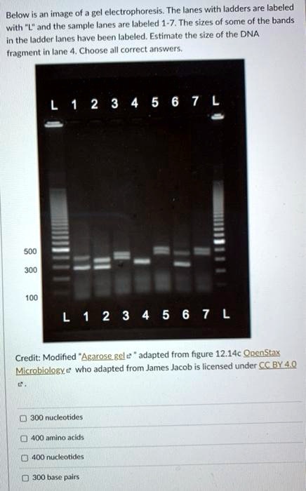 Below is an image of a gel electrophoresis. The lanes with ladders are ...