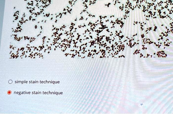 SOLVED: simple stain technique negative stain technique