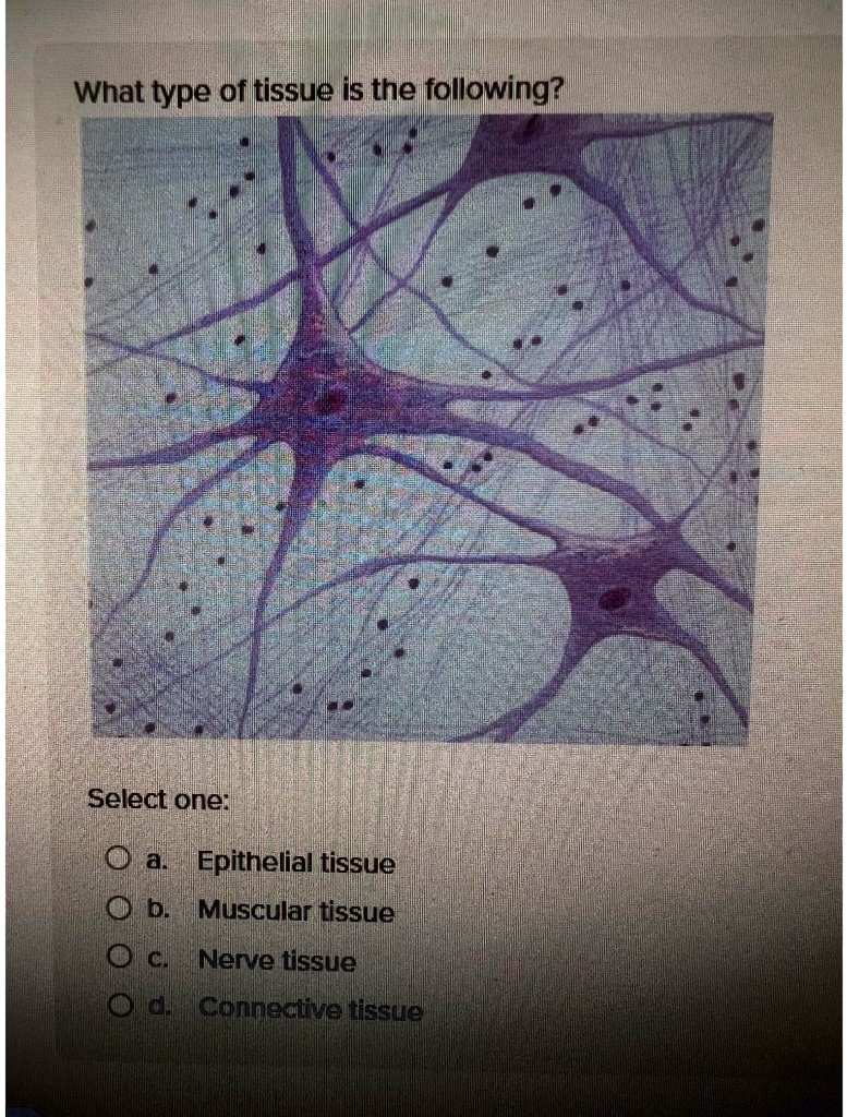 What type of tissue is the following? Select one: a. Epithelial tissue ...