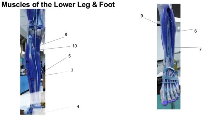 SOLVED: label the muscles of the leg and foot Muscles of the Lower Leg ...