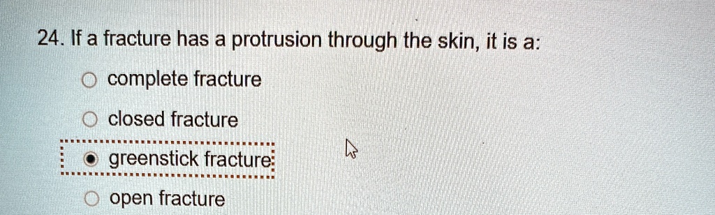 24. If a fracture has a protrusion through the skin, it is a ...