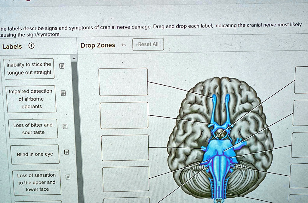[GET ANSWER] The labels describe signs and symptoms of cranial nerve ...