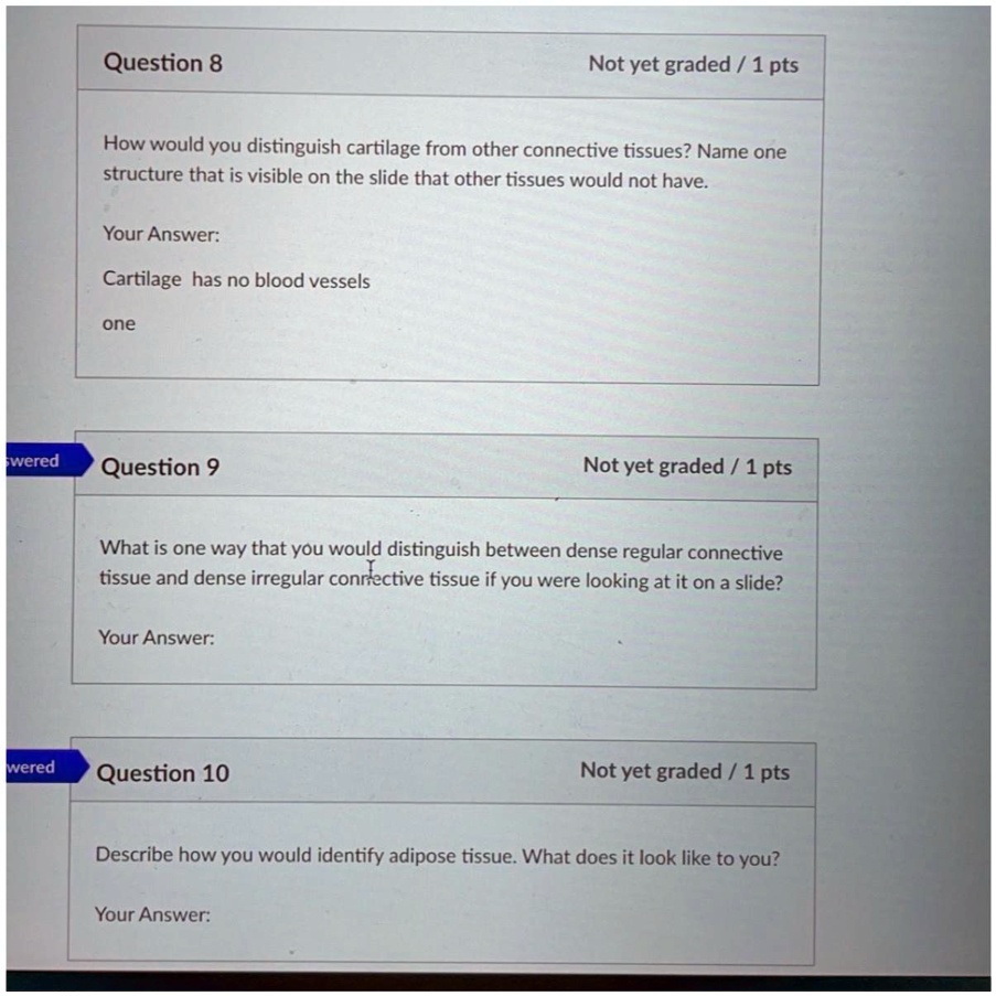 SOLVED: Question 8 Not yet graded / 1 pts How would you distinguish cartilage from other ...