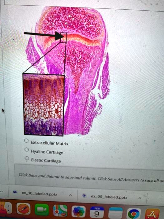 SOLVED: Extracellular Matrix Hyaline Cartilage Elastic Cartilage
