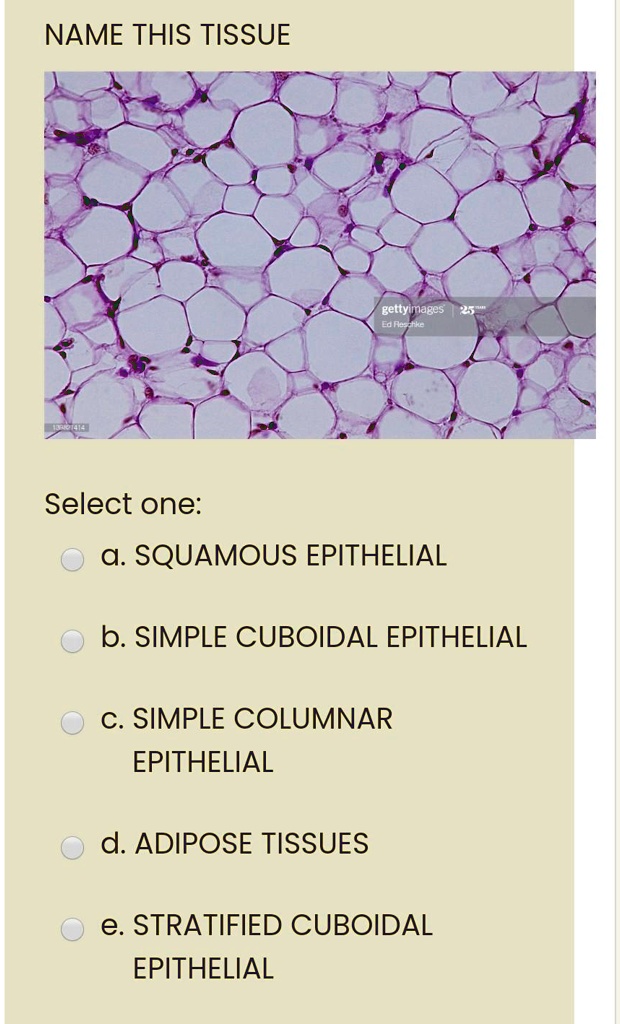 SOLVED: NAME THIS TISSUE Getty Images Select one: a. SQUAMOUS EPITHELIAL b. SIMPLE CUBOIDAL ...
