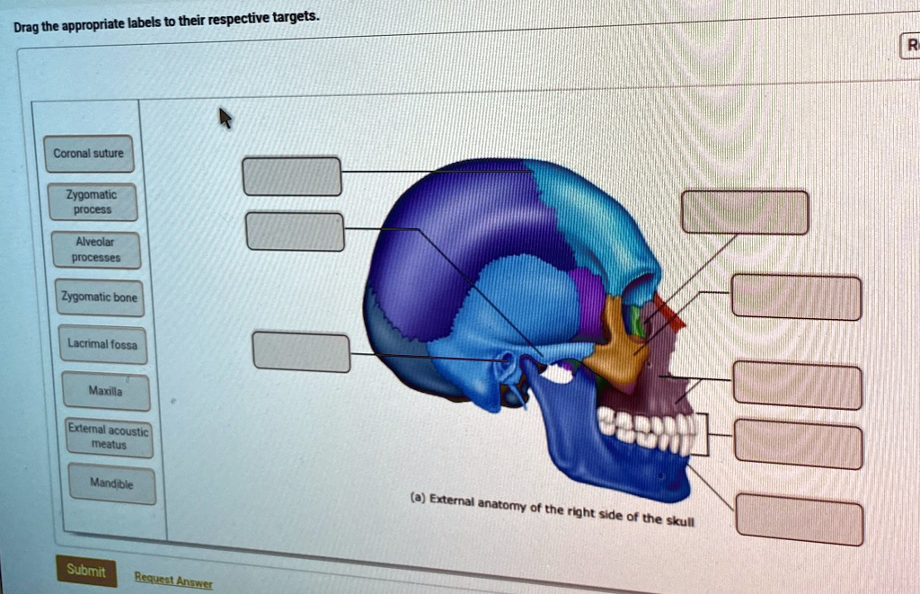 Drag the appropriate labels to their respective targets. Coronal suture Zygomatic process ...