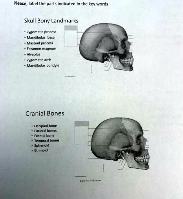 SOLVED: Skull Bony Landmarks Zygomatic process, Mandibular fossa ...