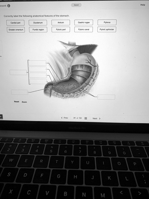SOLVED: Correctly label the following anatomical features of the ...
