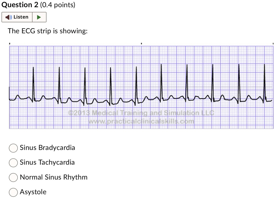 question 2 04 points listen the ecg strip is showing 2013 medical ...