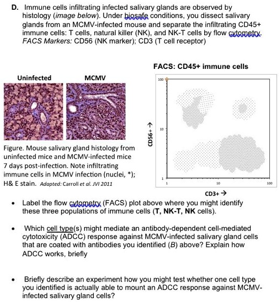 SOLVED: Immune cells infiltrating infected salivary glands are observed by histology (image ...