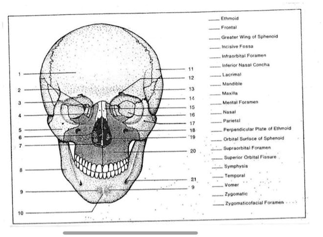 Ethmoid Frontal Greater Wing of Sphenoid Incisive Fossa Infraorbital ...