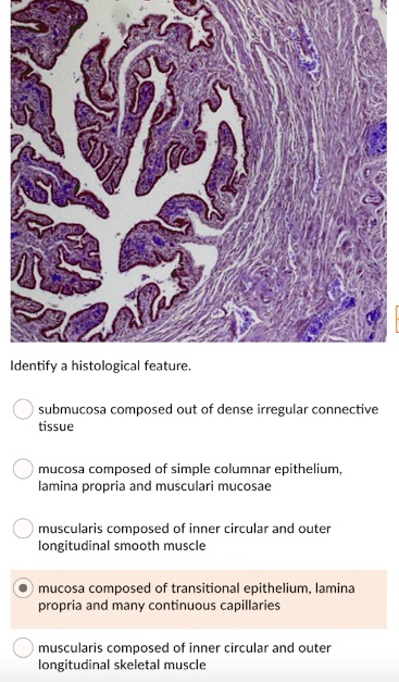 SOLVED: Identify histological teamure submucosa composed out of densc ...