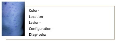 SOLVED: 'Color: Location: Lesion: Configuration: Diagnosis: Color ...