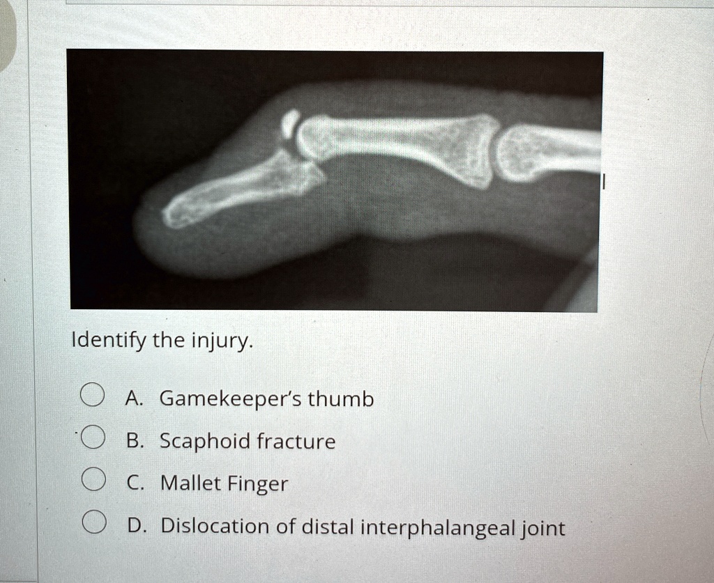 identify the injury a gamekeepers thumb b scaphoid fracture c mallet finger d dislocation of ...