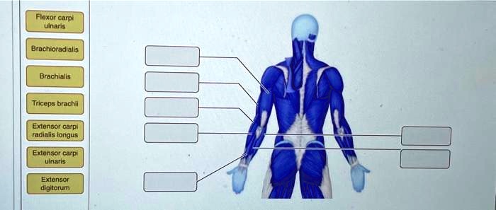 SOLVED: Texts: need help solving Flexor carpi ulnaris Brachioradialis ... SOLVED: Texts: need help solving Flexor carpi ulnaris Brachioradialis ...