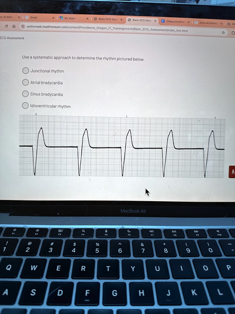 use a systematic approach to determine the rhythm pictured below ...