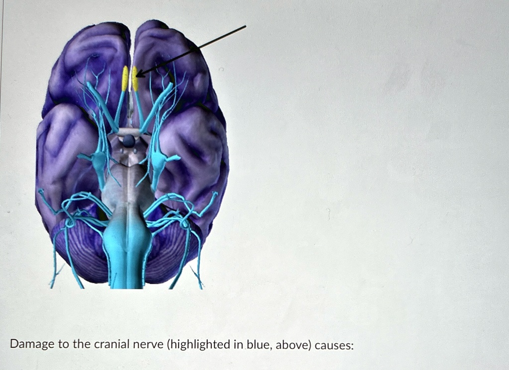 damage to the cranial nerve highlighted in blue above causes damage to ...