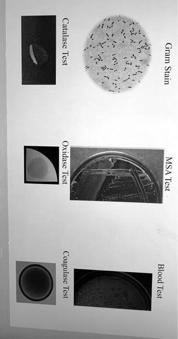 SOLVED: 1 Test Gram Stain Oxidase Test MSA Test Coagulase Test Blood ` Test
