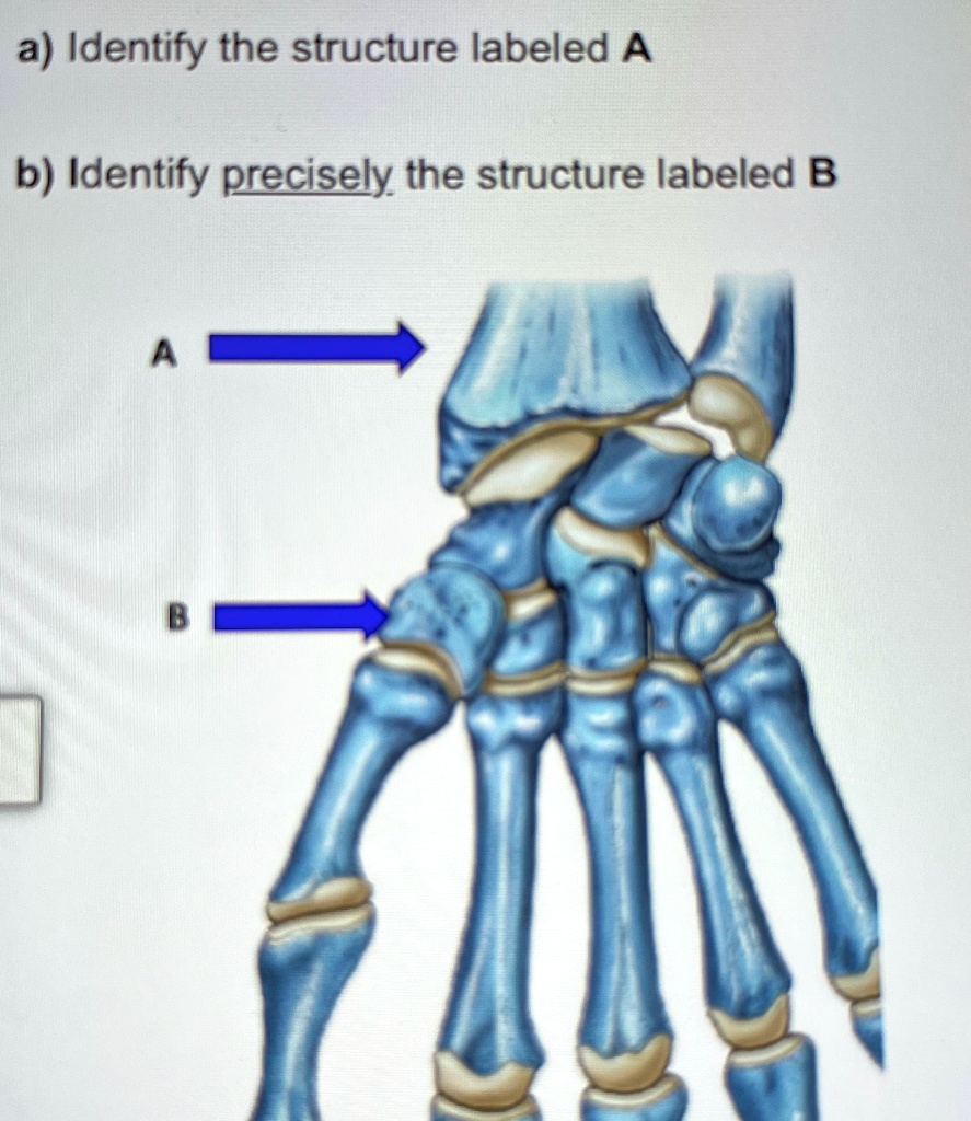 SOLVED: a) Identify the structure labeled A b) Identify precisely the ... SOLVED: a) Identify the structure labeled A b) Identify precisely the ...