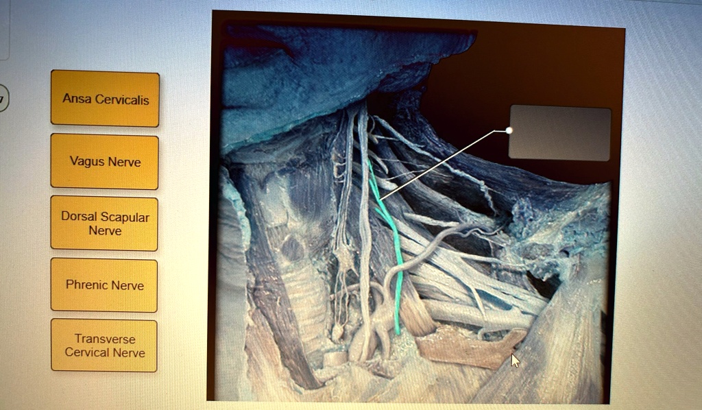 ? Ansa Cervicalis Vagus Nerve Dorsal Scapular Nerve Phrenic Nerve ...