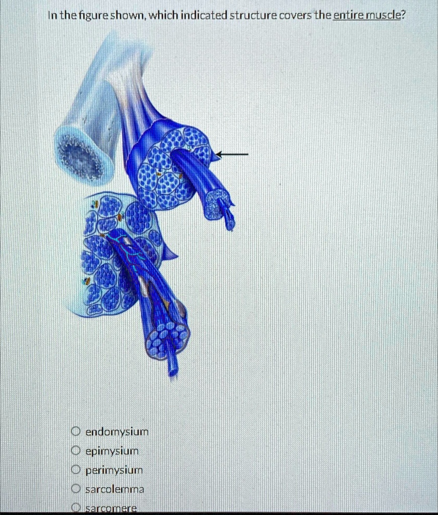 SOLVED: In the figure shown, which indicated structure covers the ...