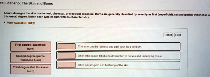 SOLVED: A burn damages the skin due to heat, chemical, or electrical ...