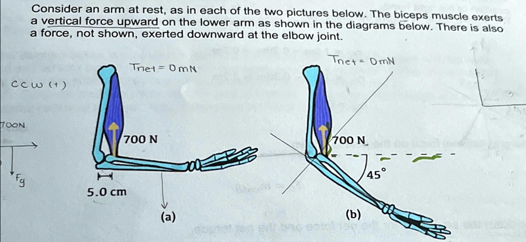 Consider an arm at rest, as in each of the two pictures below. The ...